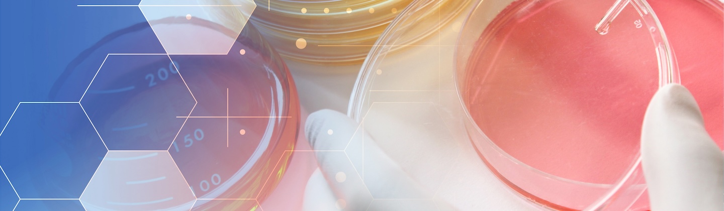 CRO [ACEL] Protein expression analysis using Simple Western (Jess)